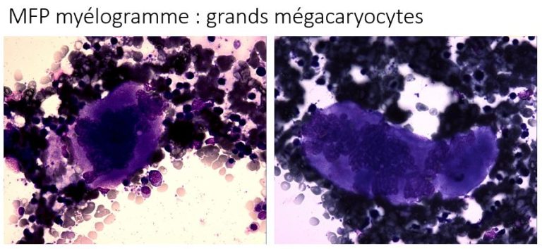 MFP- Quels examens biologiques prescrire ? | Eurofins Biomnis